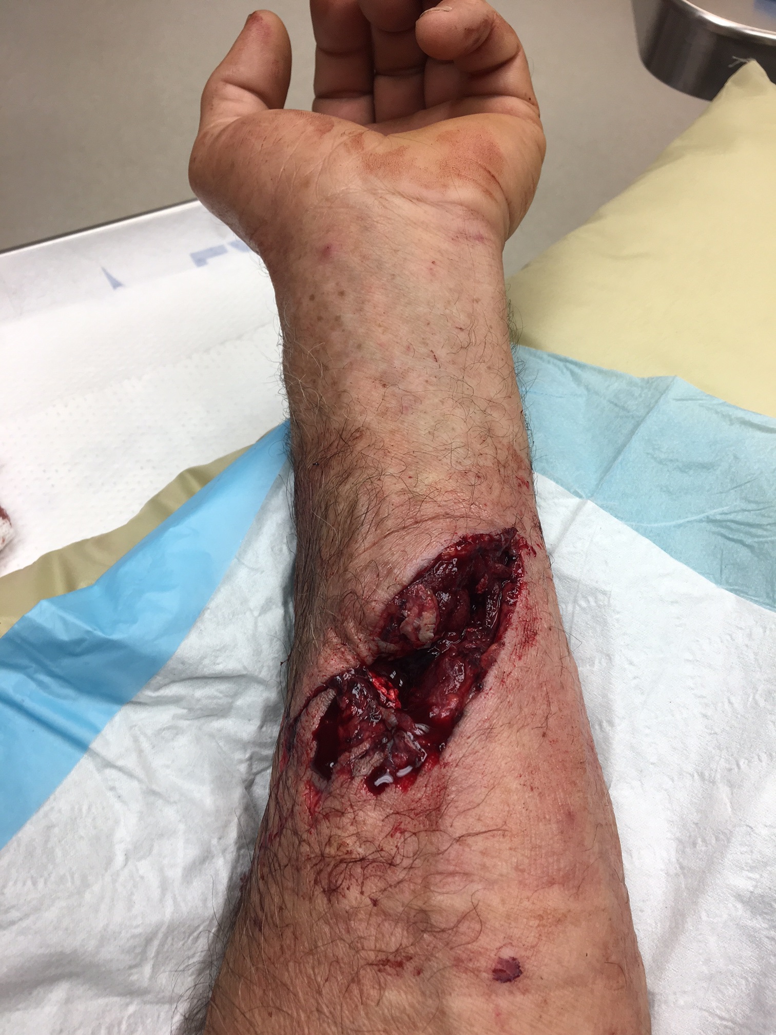 December 2017 NHSPA CME Quiz – CME4PAC